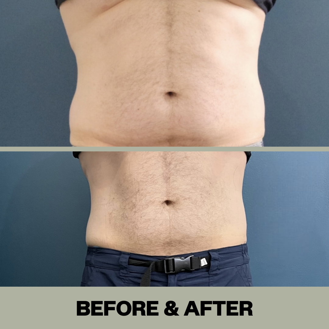 Neveskin – The Wellness Cottage & Spa